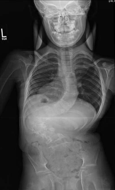 Every Spine is Different | A Chiropractor's Opinion